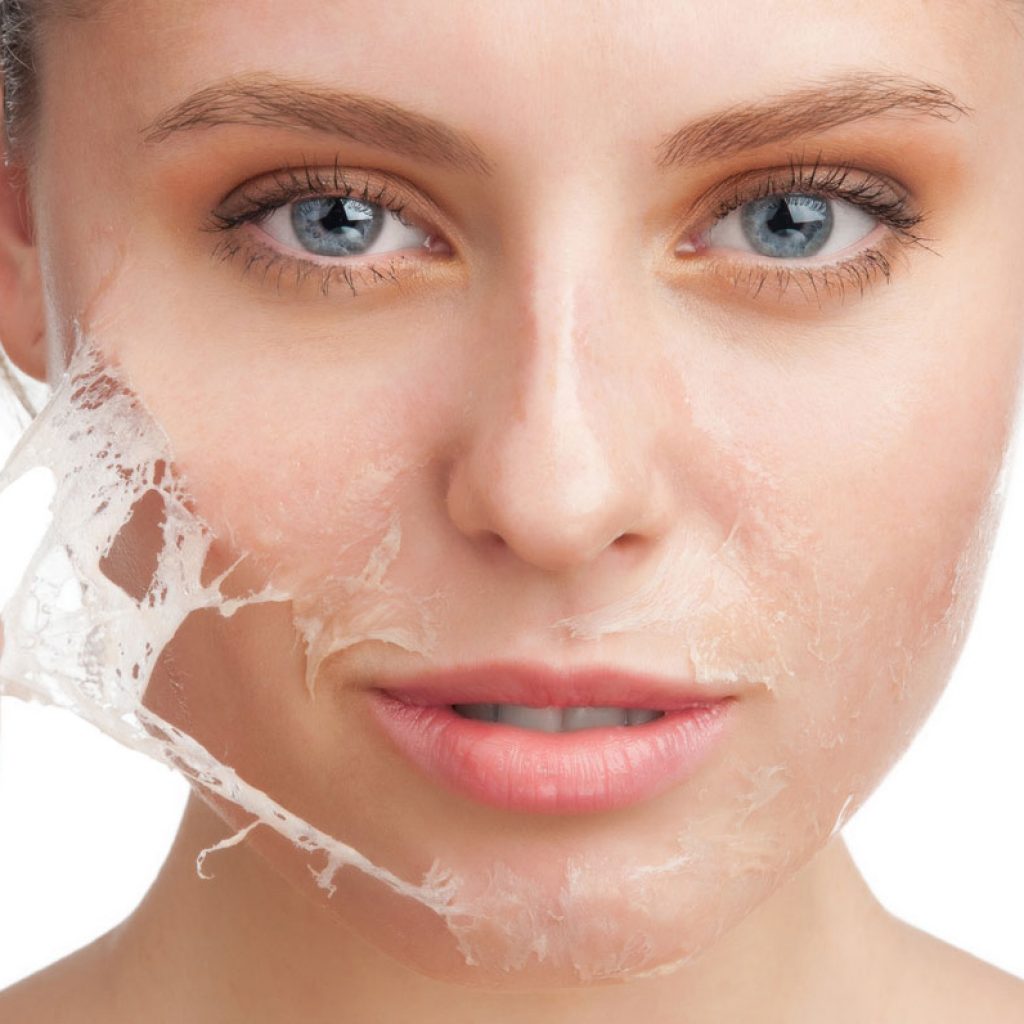 Peeling Químico - Clínica Médica Lu Dermatologia e Oftalmologia