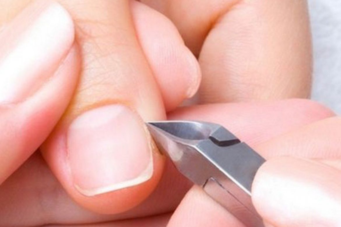 Clínica Médica Lu Dermatologia e Transplante Capilar Sorocaba SP: Unha ...